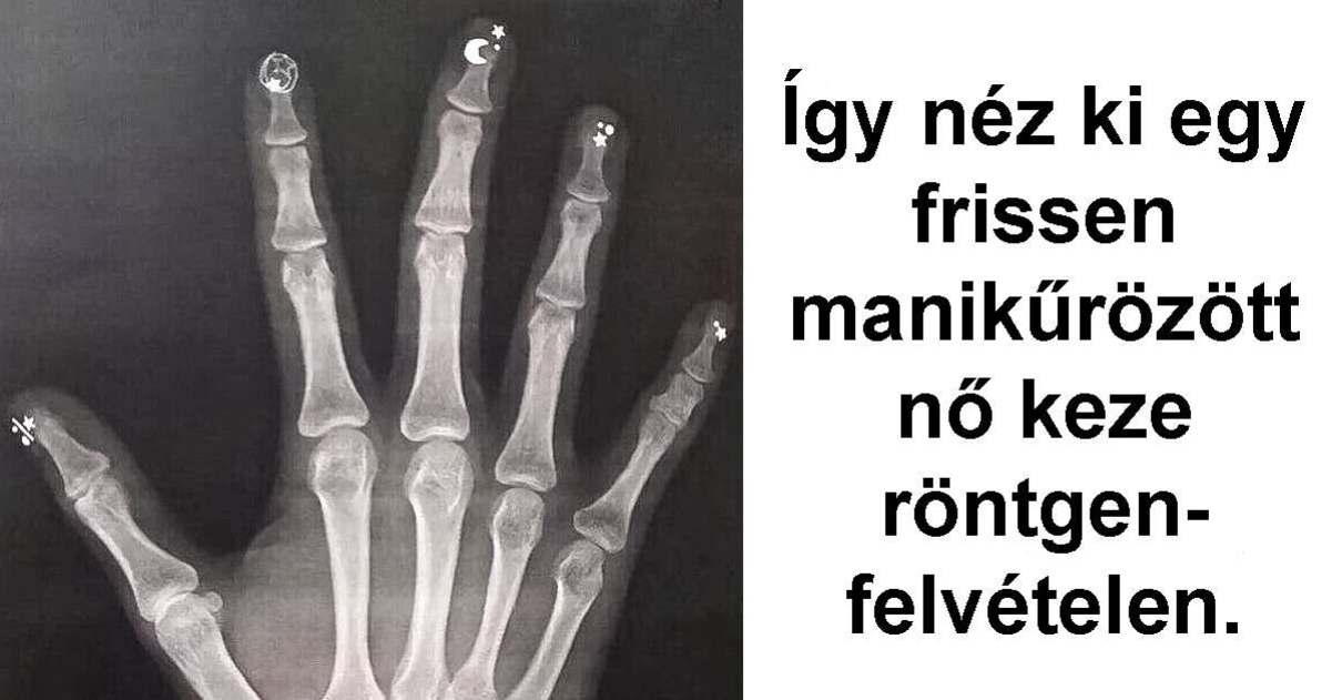 21 fotó, ami bemutatja, hogy az ismerős dolgok sokkal rejtélyesebbnek ...